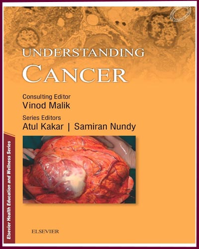 Understanding Cancer, 1e, VINOD MALIK - Mermer Online Medical Books